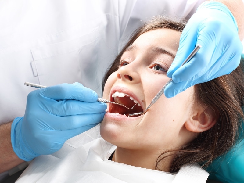 Does A Dental Fissure Sealant Change The Appearance Of Teeth?
